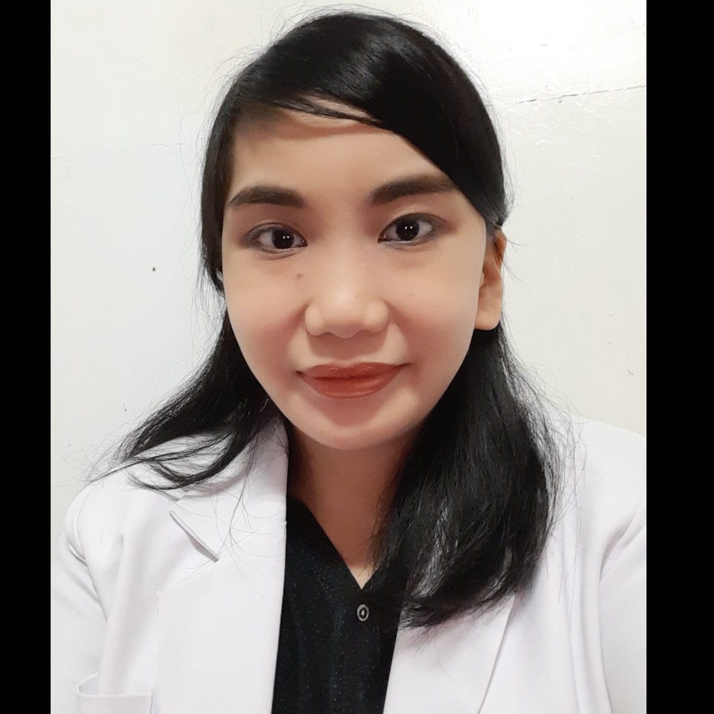 Mengenal Penyakit Virus Marburg, Gejala, Penyebab dan Pengobatannya ... Mengenal Penyakit Virus Marburg, Gejala, Penyebab dan Pengobatannya ...