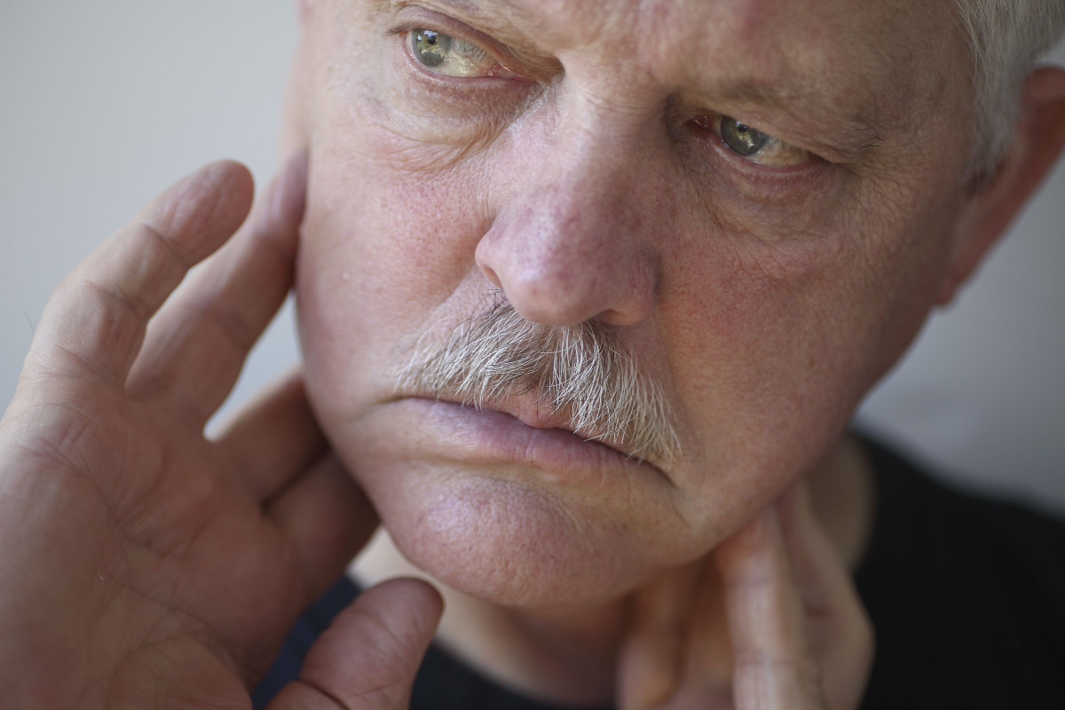 Moon Face, Kondisi Wajah yang Membengkak Bagai Bulan | YesDok