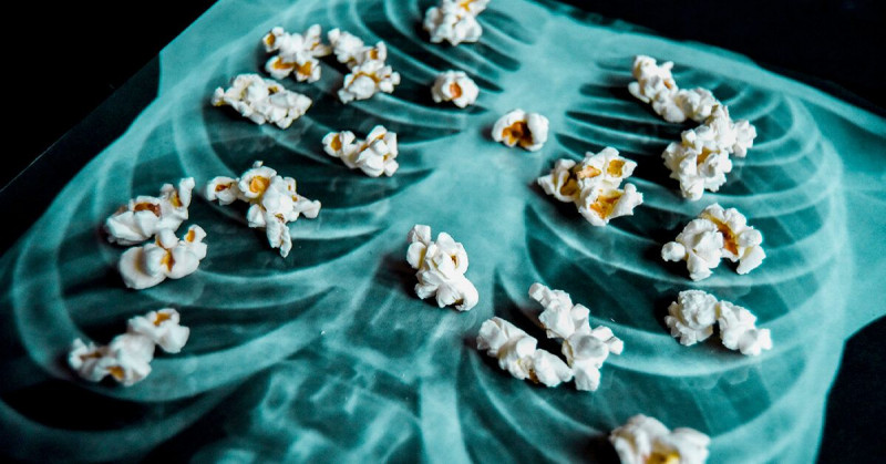 Mengenal Popcorn Lung, Gejala, Penyebab, dan Cara Mengobati - News+ on ...