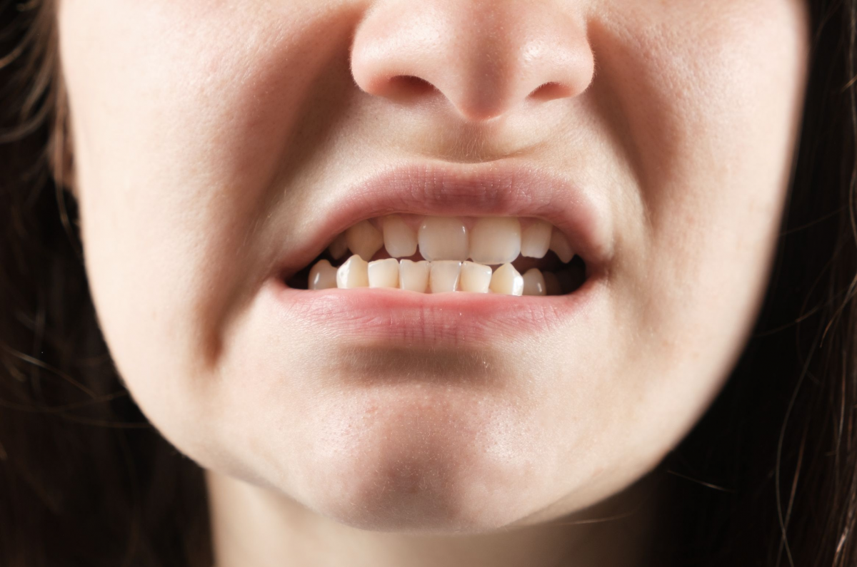 Penyebab Dislokasi Rahang yang Perlu Anda Perhatikan | Yesdok.com