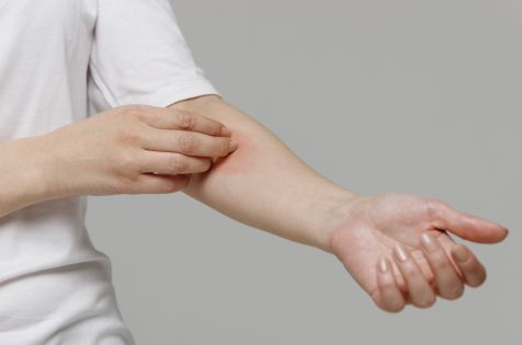 Kenali Penyebab dan Cara Mengobati Bisul | YesDok