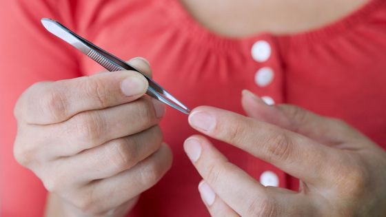 Apa Itu Hair Splinter? Kondisi Kesusupan Rambut yang Bikin Nyeri | YesDok