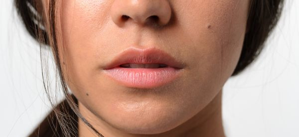 Apa Itu Kanker Nasofaring? Ini Faktor Risiko dan Gejalanya | YesDok