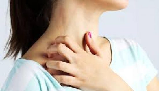 Jenis Eksim yang Perlu Anda Ketahui | YesDok