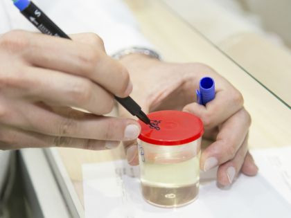 4 Penyebab Kencing Berbusa | YesDok